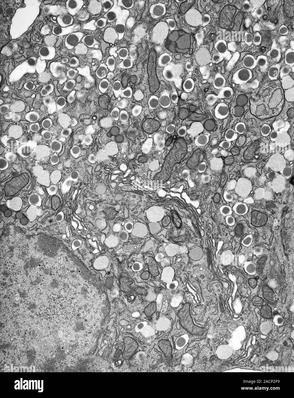 Islet of Langerhans beta cell. Transmission electron micrograph (TEM ...
