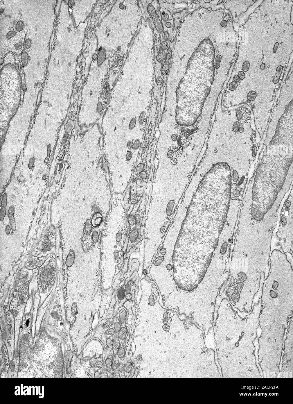 Smooth muscle tissue. Transmission electron micrograph (TEM) of a ...