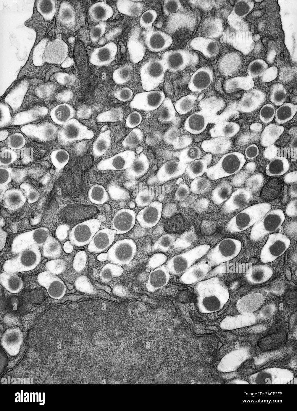 Islet of Langerhans beta cell. Transmission electron micrograph (TEM ...