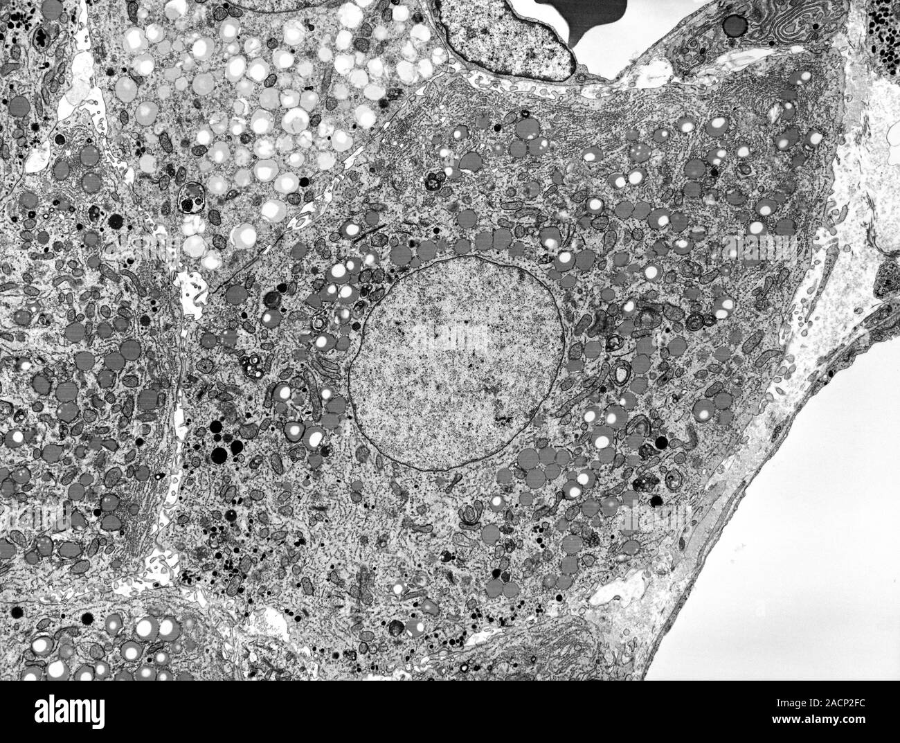 Corpus luteum. Transmission electron micrograph (TEM) of a section ...