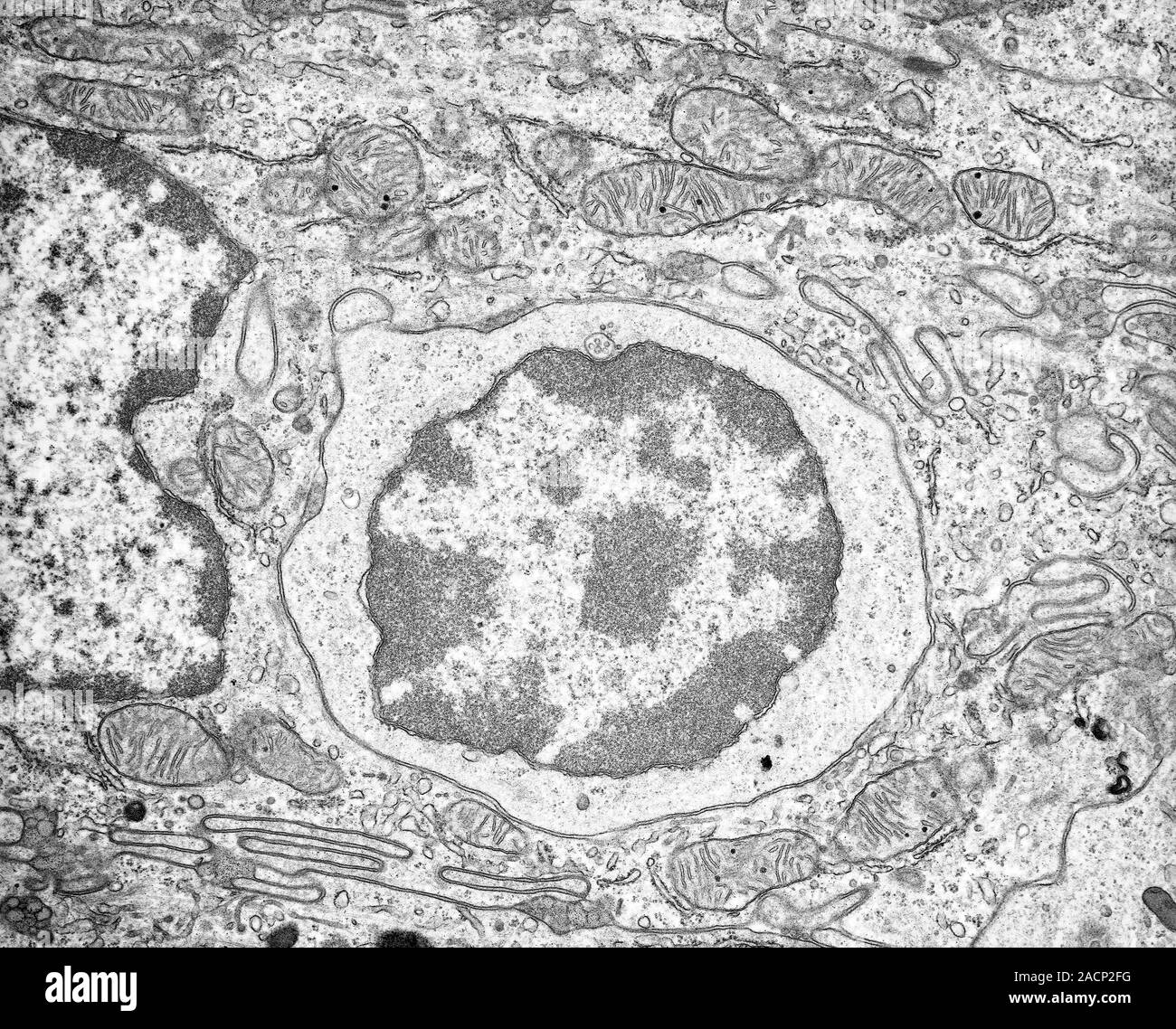 Lymphocyte white blood cell. Transmission electron micrograph (TEM) of ...
