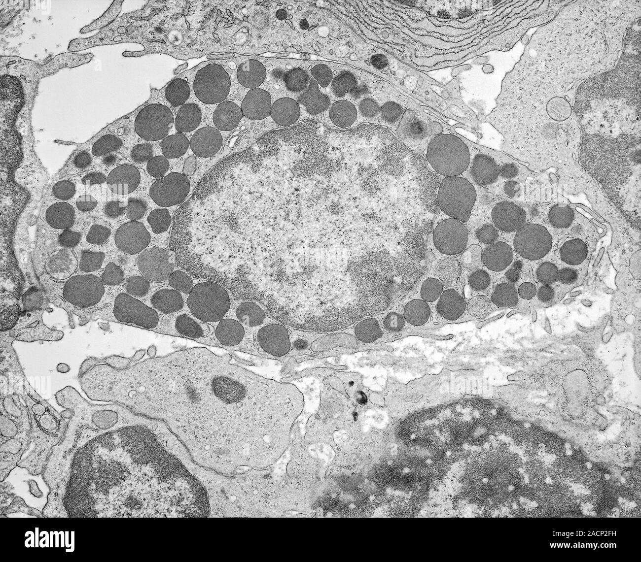 Mast cell. Transmission electron micrograph (TEM) of section through a ...