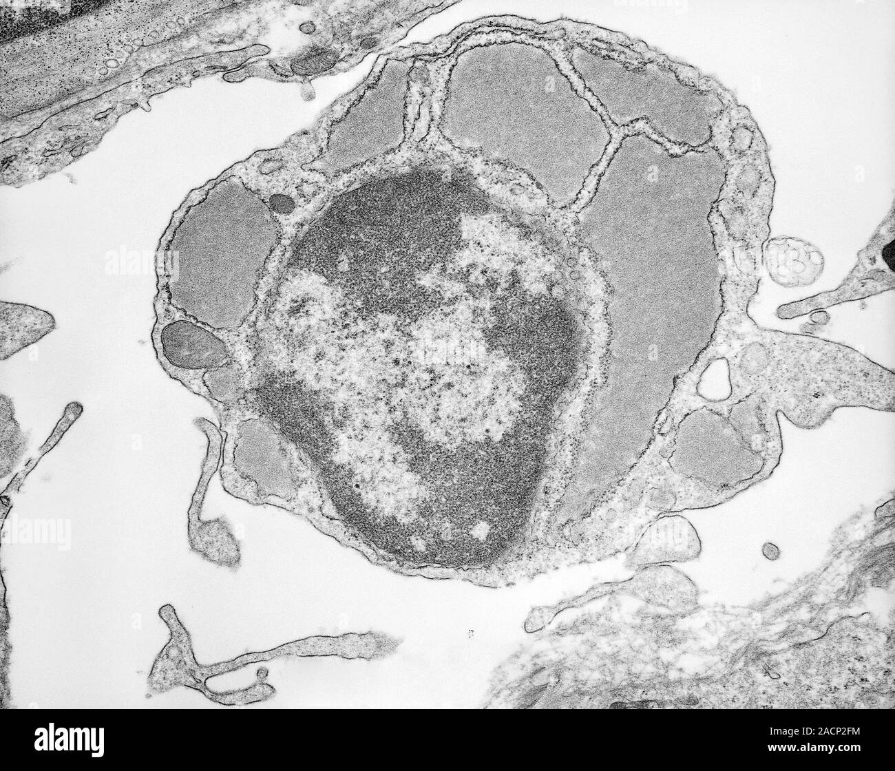 Plasma cell. Transmission electron micrograph (TEM) of a section ...