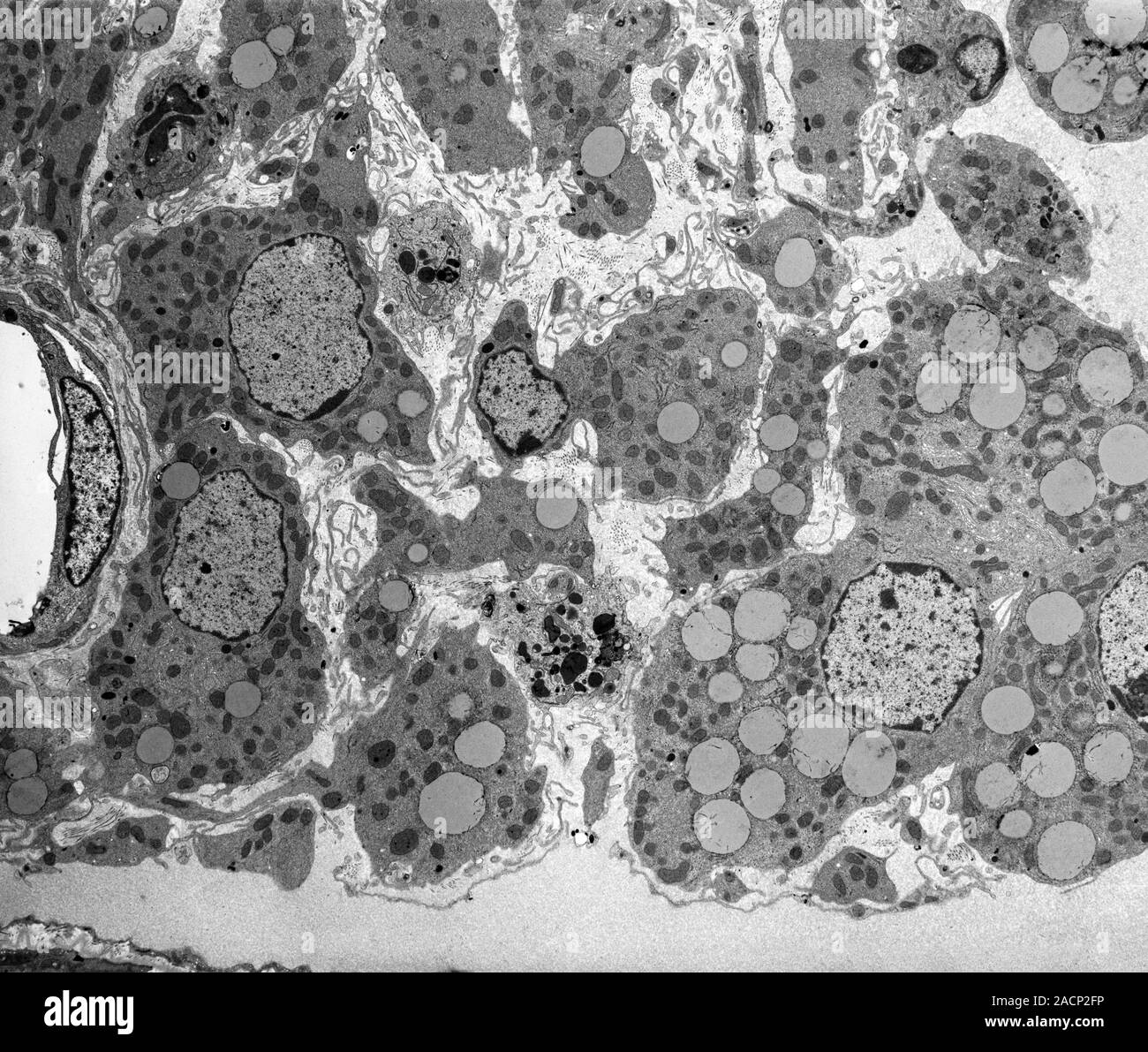 Leydig cells. Transmission electron micrograph (TEM) of a section ...