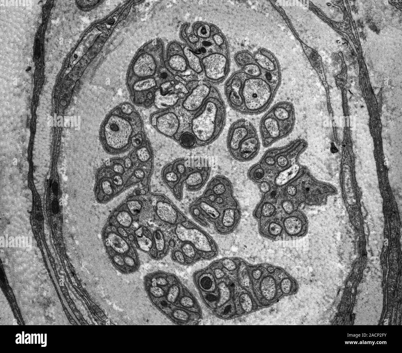 Unmyelinated nerve. Transmission electron micrograph (TEM) of a section ...