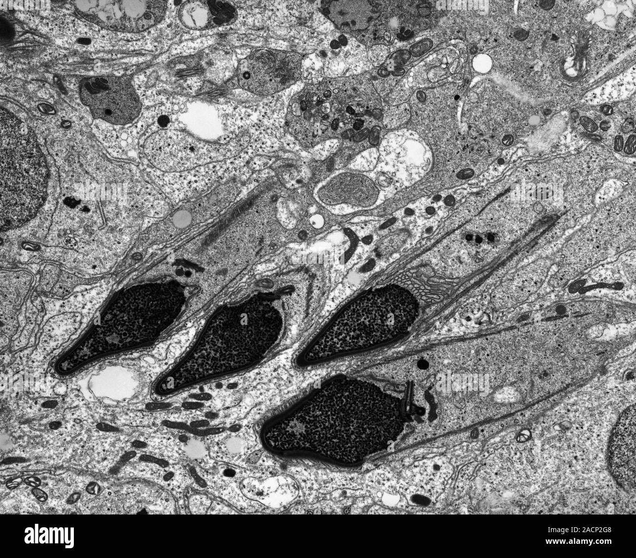Human spermatids. Transmission electron micrograph (TEM) of a section ...