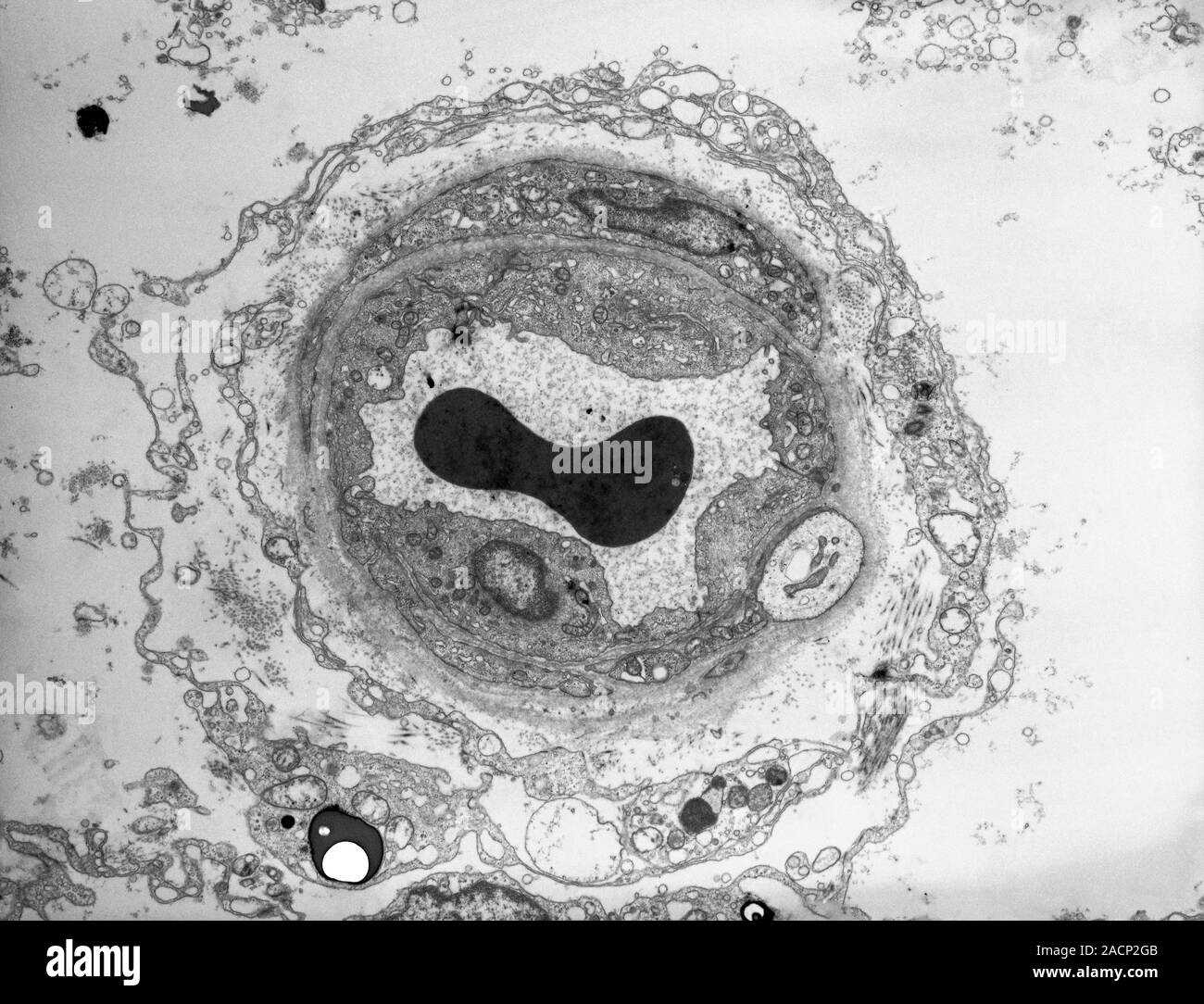 Capillary. Transmission electron micrograph (TEM) of a section through ...