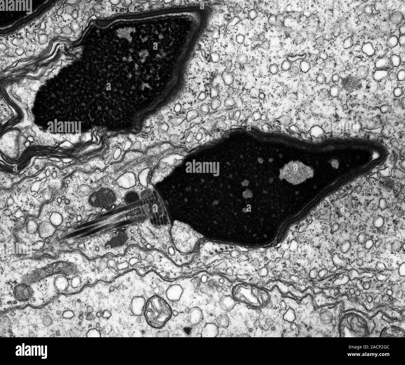 Human spermatids. Transmission electron micrograph (TEM) of a section ...