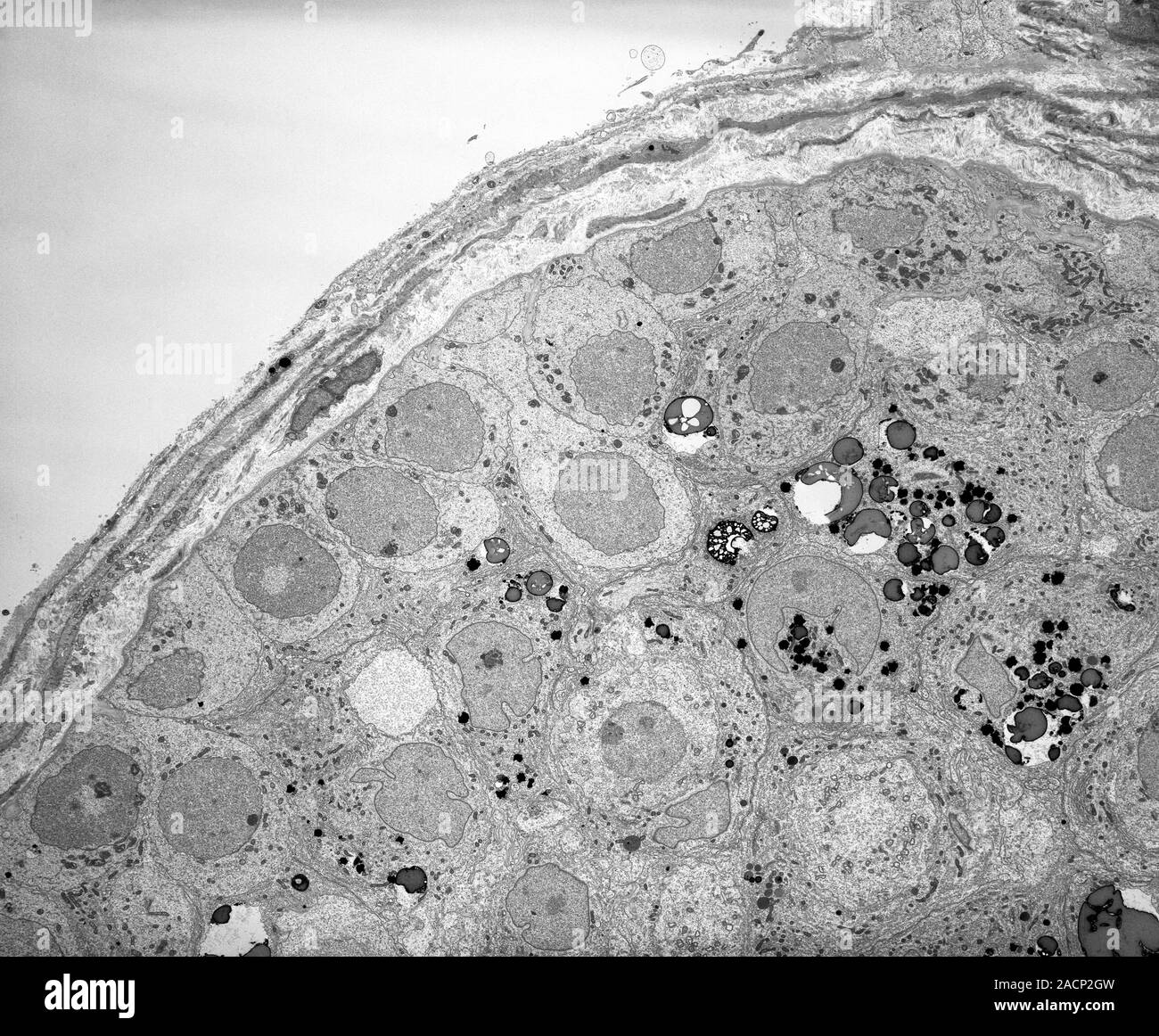 Seminiferous tubule. Transmission electron micrograph (TEM) of a ...