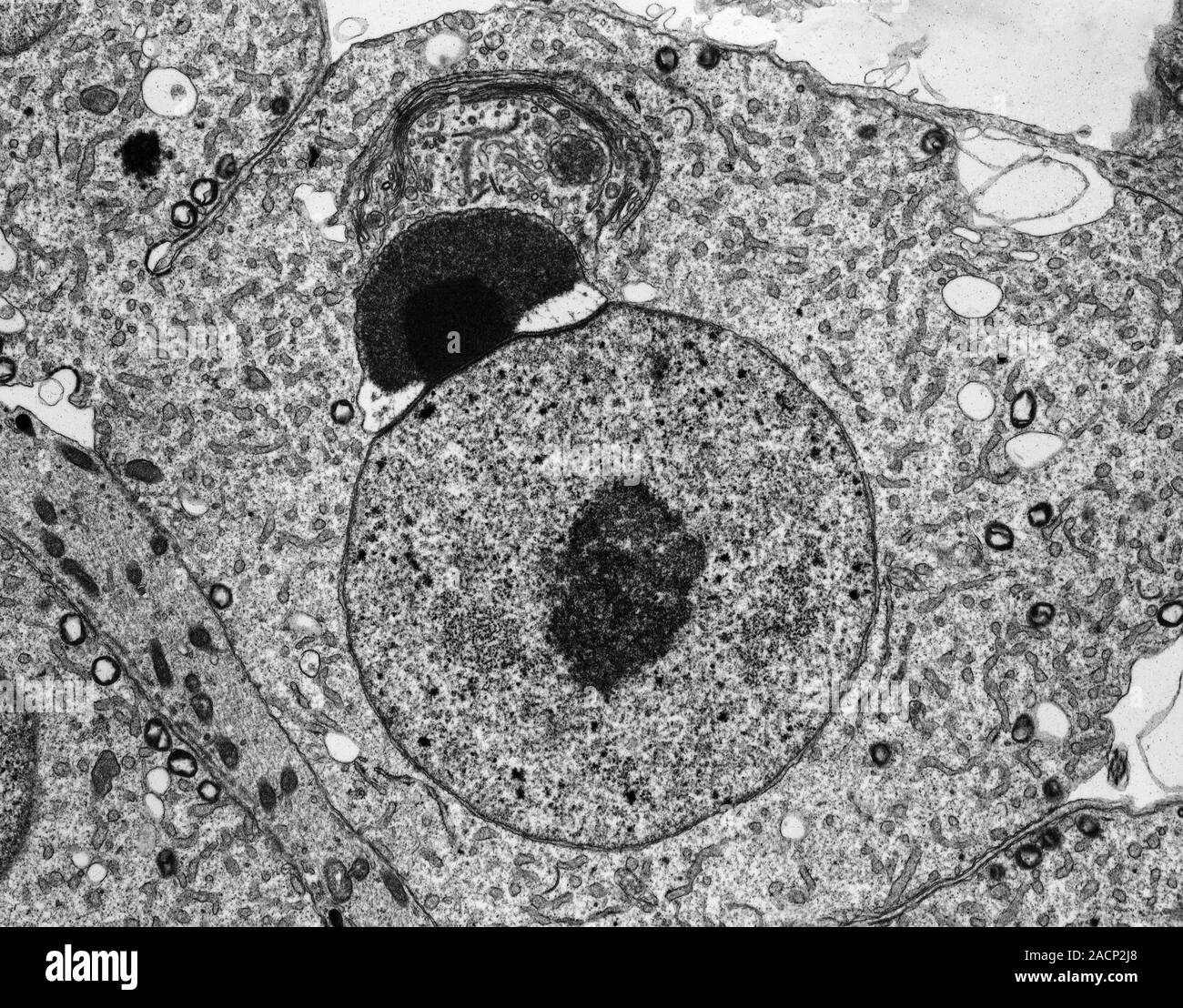 Human Spermatid Transmission Electron Micrograph Tem Of A Section