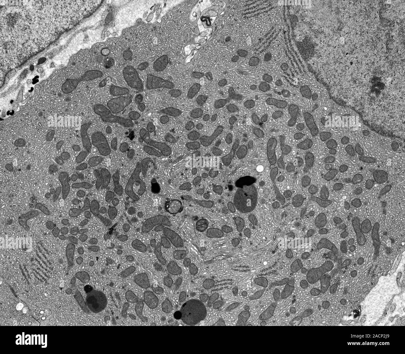 Steroid secreting cell. Transmission electron micrograph (TEM) of a ...