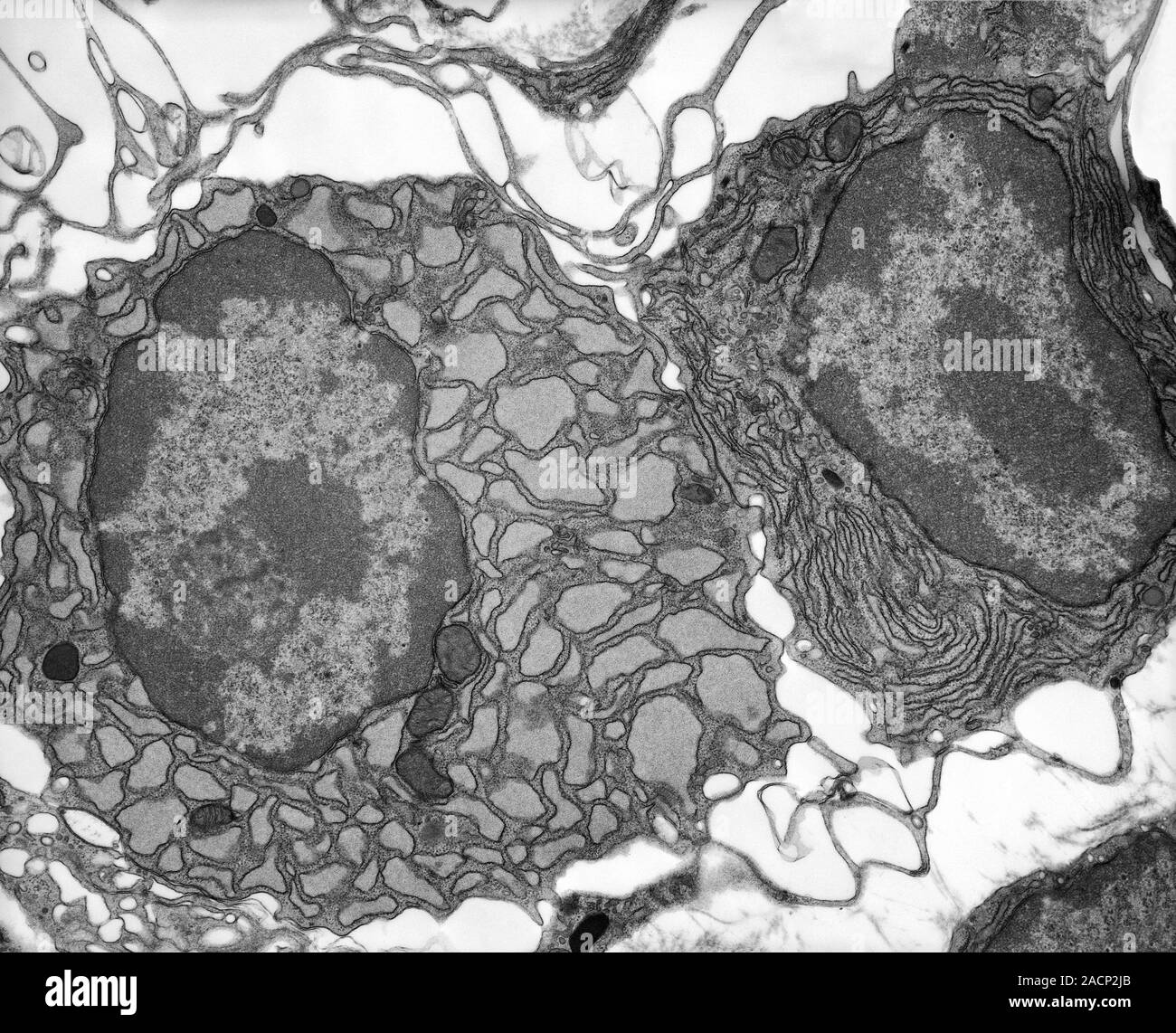 Plasma cells. Transmission electron micrograph (TEM) of a section ...