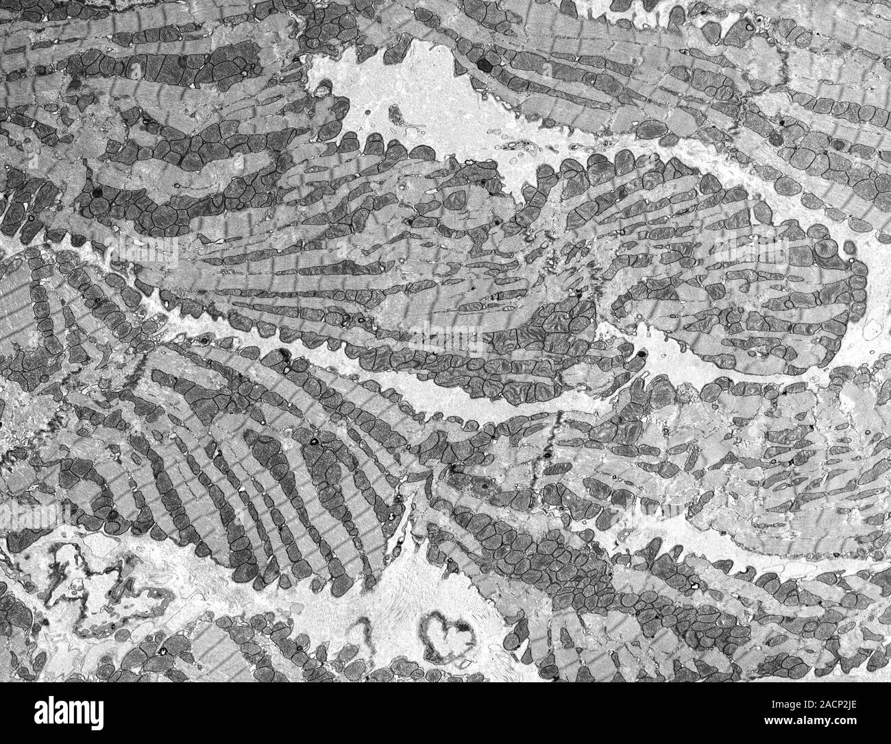 Cardiac Muscle Transmission Electron Micrograph Tem Of A