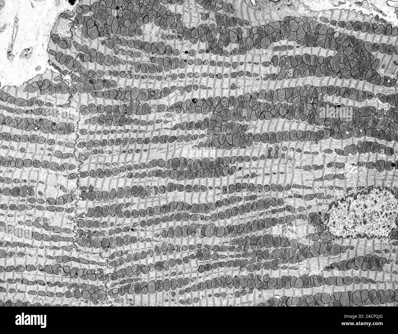 Cardiac muscle. Transmission electron micrograph (TEM) of a longitudinal section through cardiac ...