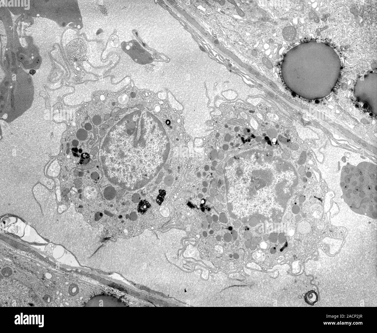 Macrophage white blood cells. Transmission electron micrograph (TEM) of ...