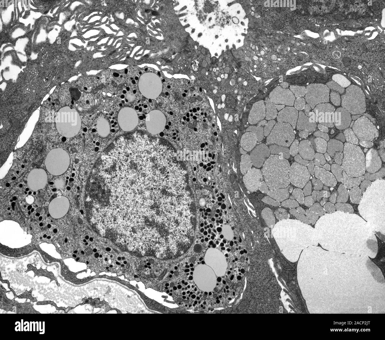 Enteroendocrine cell. Transmission electron micrograph (TEM) of a ...