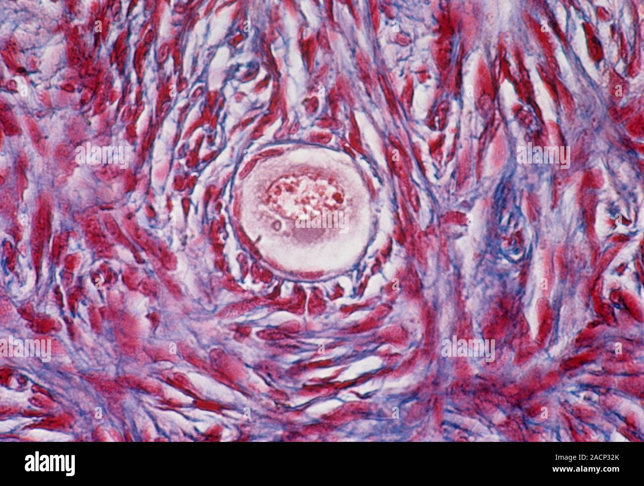 Light micrograph of a primordial follicle (at centre) surrounded by ...