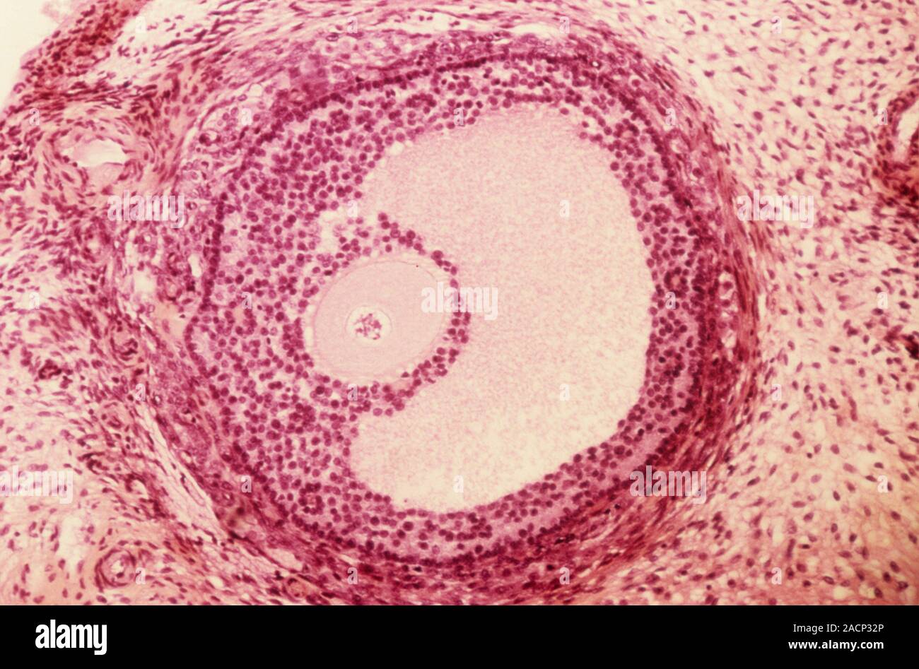 Light micrograph of a Graafian follicle (at centre) containing a ...