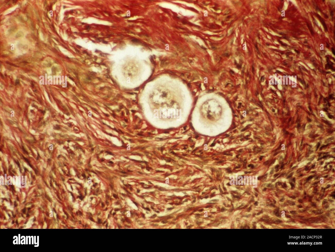 Light micrograph of three primordial follicles (at centre) surrounded ...