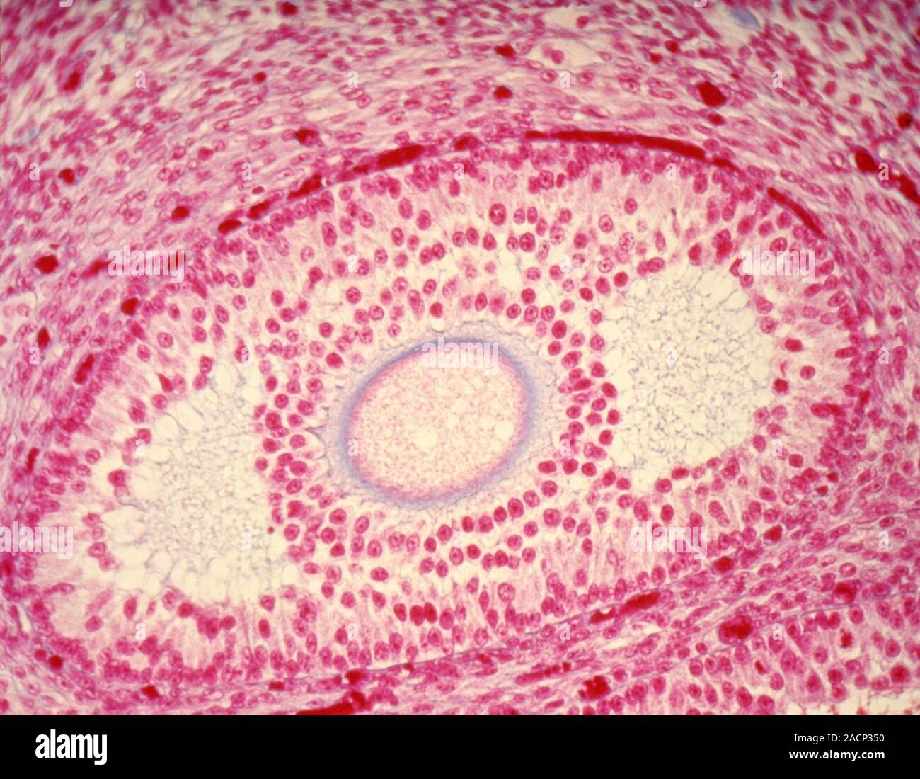 Light micrograph of a Graafian follicle containing a secondary oocyte ...
