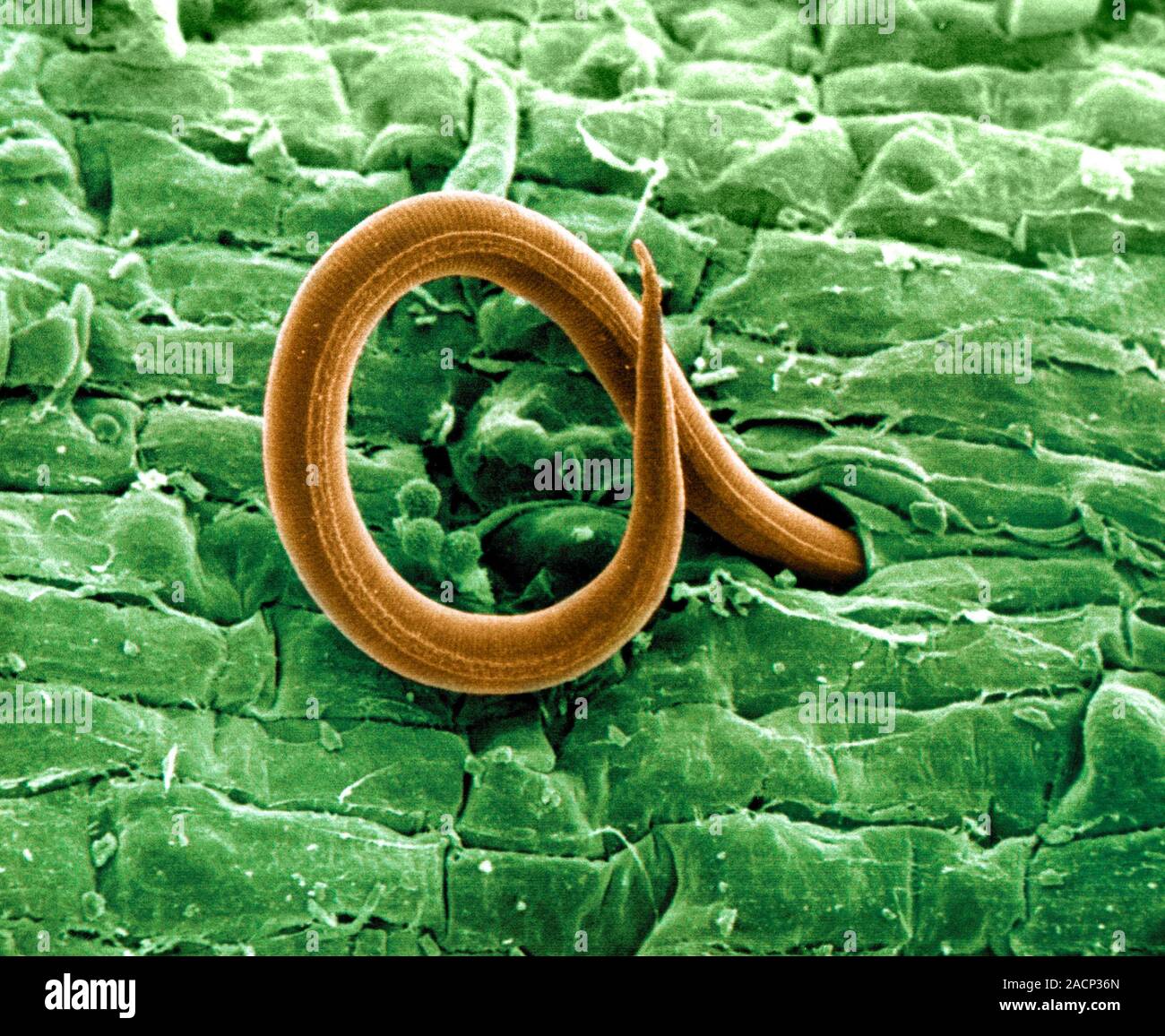 Root-knot nematode larva. Coloured scanning electron micrograph (SEM ...