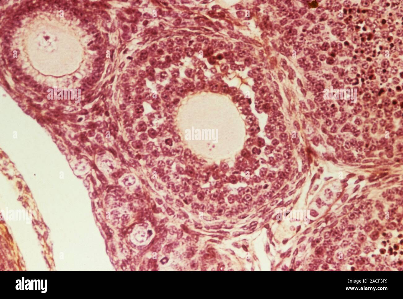 Ovarian follicles. Light micrograph of a section through tissue from an ...