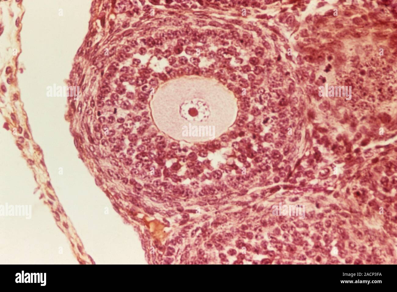 Ovarian follicle. Light micrograph of a section through tissue from an ...