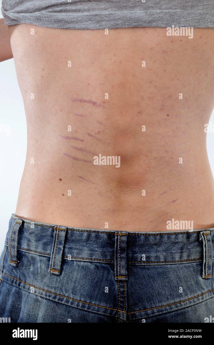 Not for use in Television Not for use in Television View of the back of ...