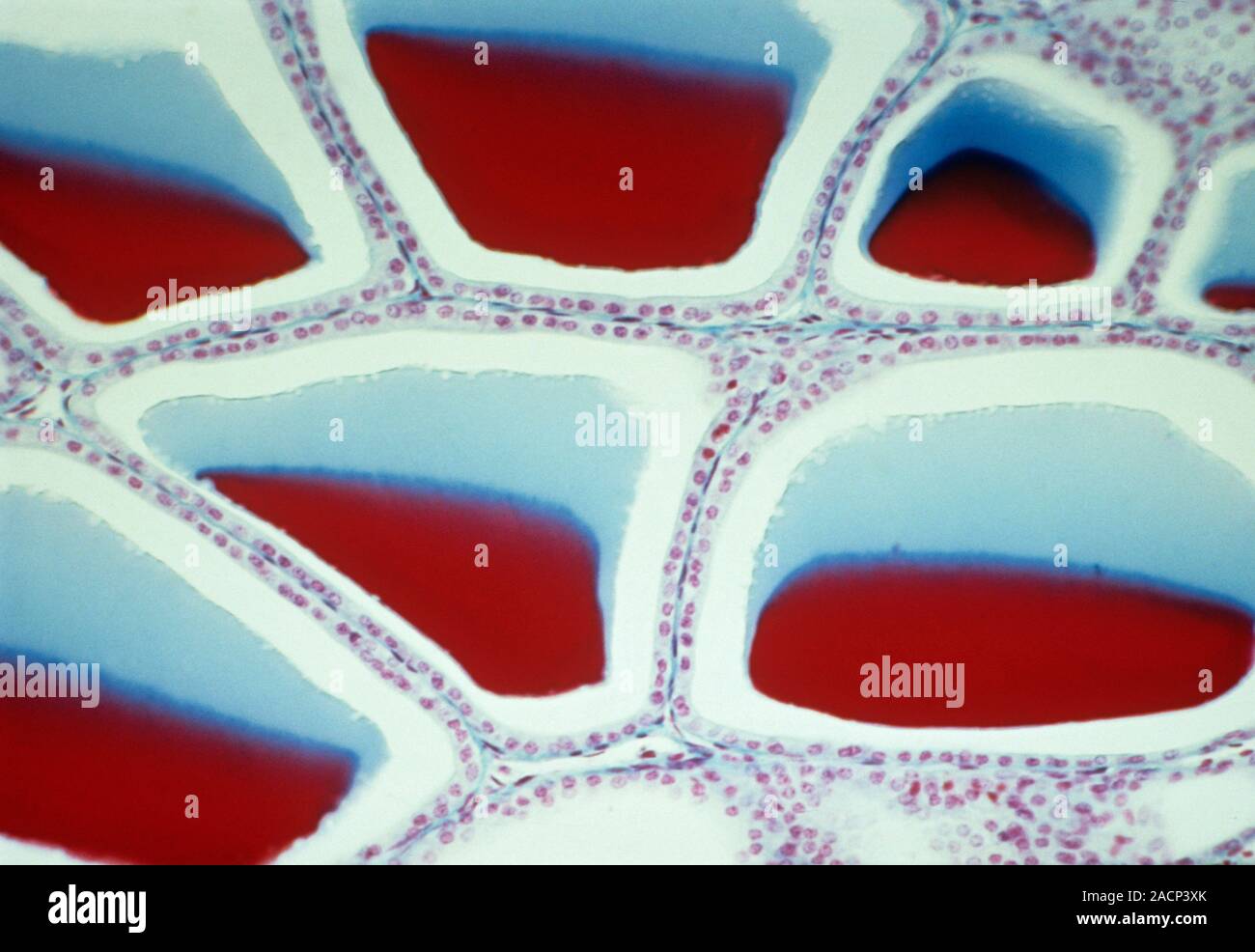 Thyroid Follicles Light Micrograph Of A Section Through A Thyroid Gland Showing The Follicles