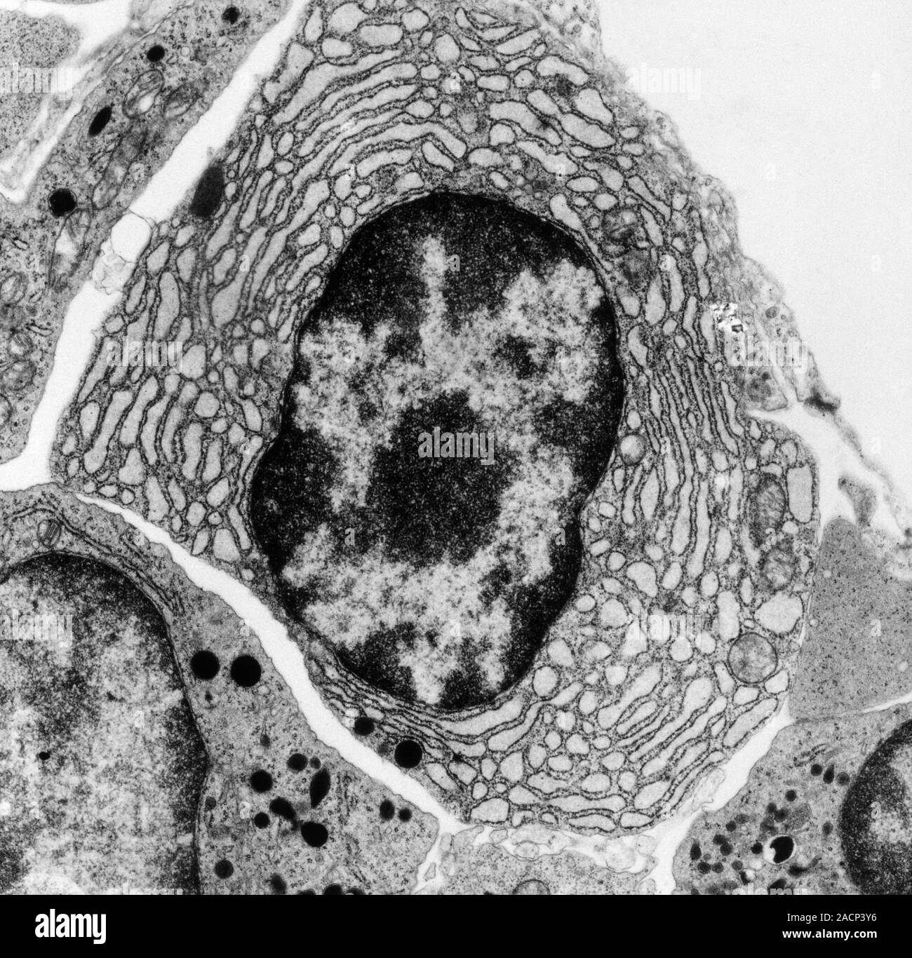Activated plasma cell, transmission electron micrograph (TEM). Plasma ...