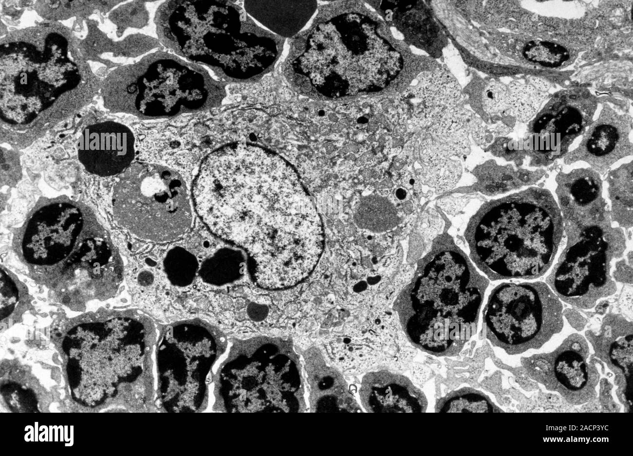 Macrophage and lymphocytes, transmission electron micrograph (TEM ...