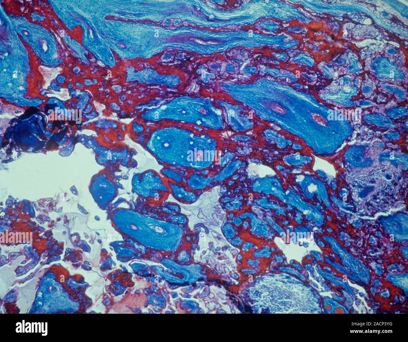 Placenta. Light micrograph of a section through placental tissue ...