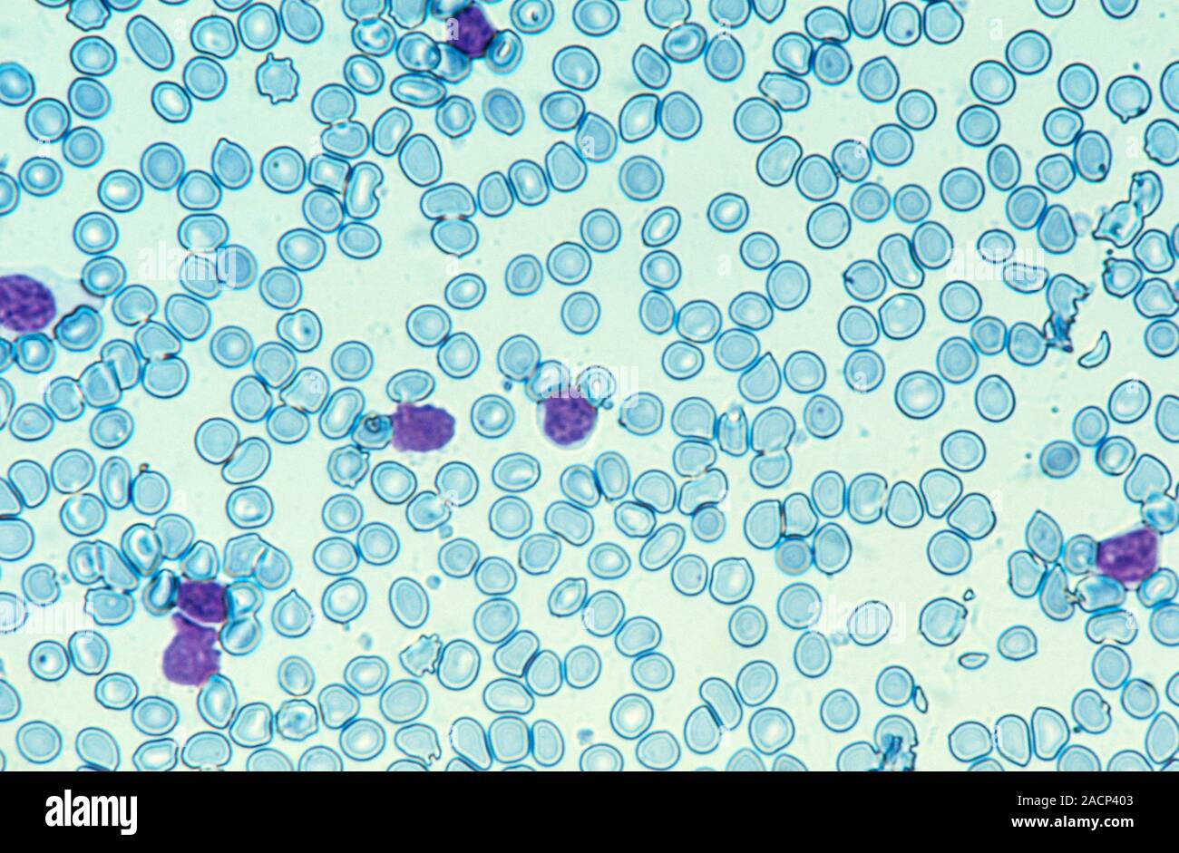 Blood cells. Light micrograph of red blood cells (erythrocytes, light ...