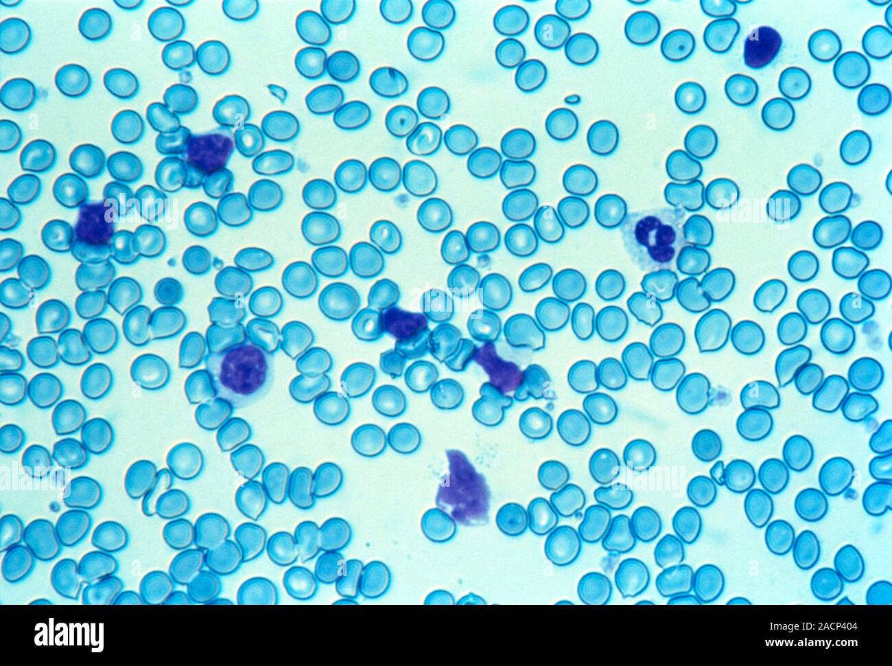 Blood cells. Light micrograph of red blood cells (erythrocytes, light ...