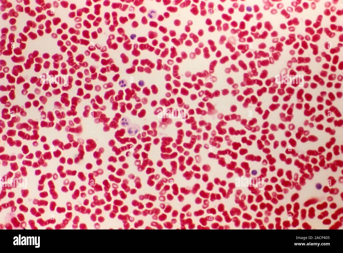 Blood cells. Light micrograph of red blood cells (erythrocytes, red ...