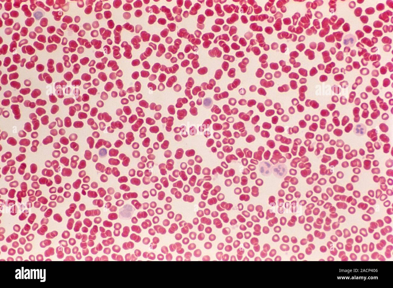 Blood cells. Light micrograph of red blood cells (erythrocytes, red ...