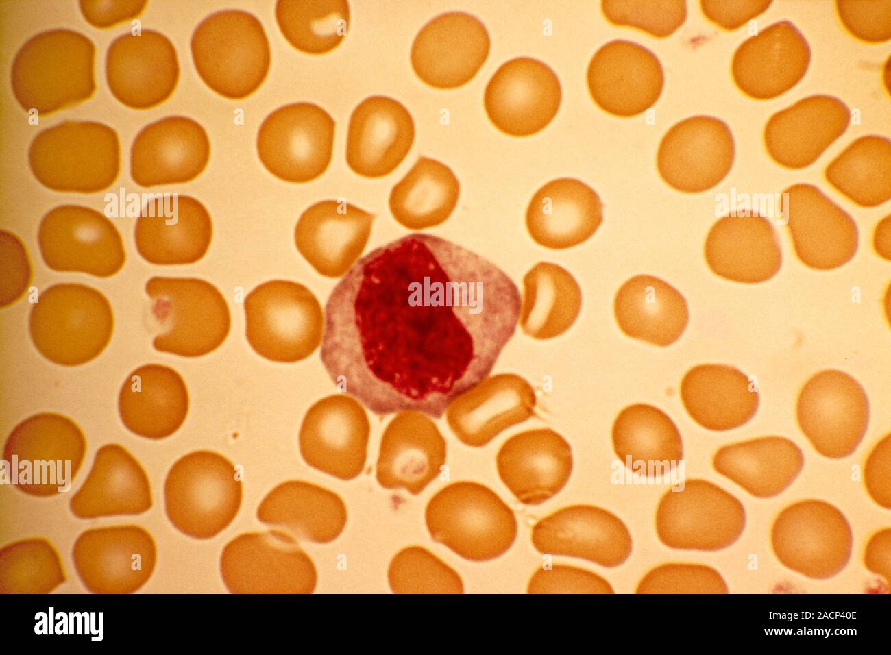 Monocyte blood cell, light micrograph. Monocytes are a type of white ...