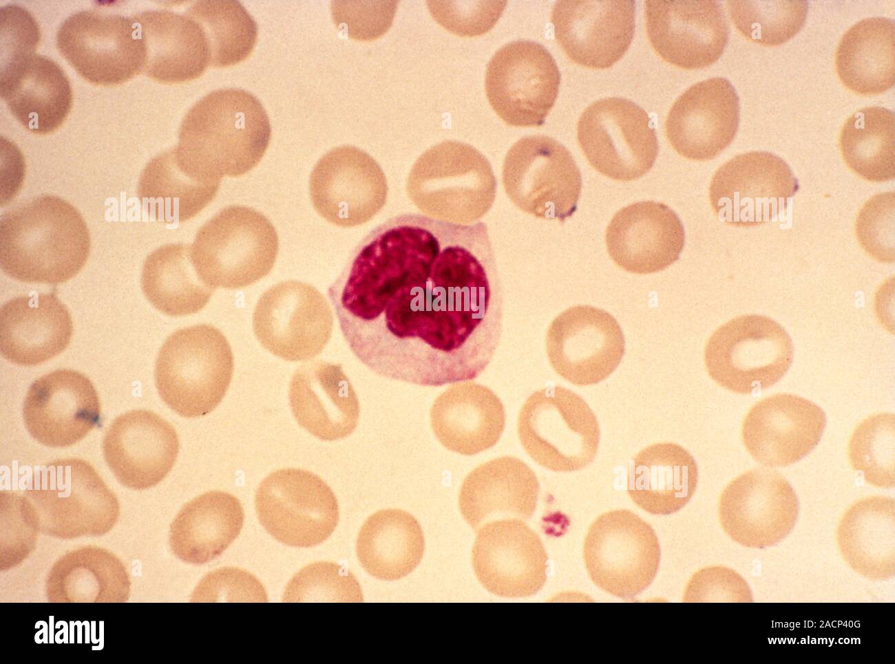 Monocyte blood cell, light micrograph. Monocytes are a type of white ...