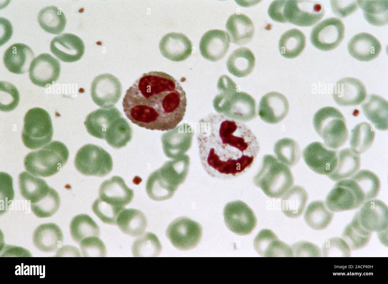 Granulocyte blood cells. Light micrograph of two types of granulocytes ...
