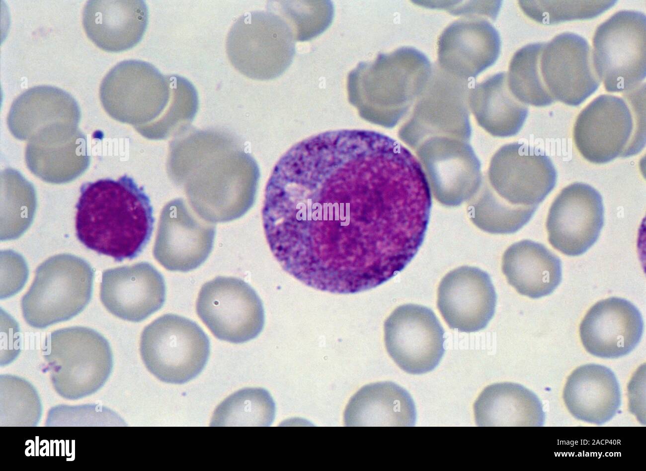 Promyelocyte blood cell, light micrograph. This blood cell (centre) is ...