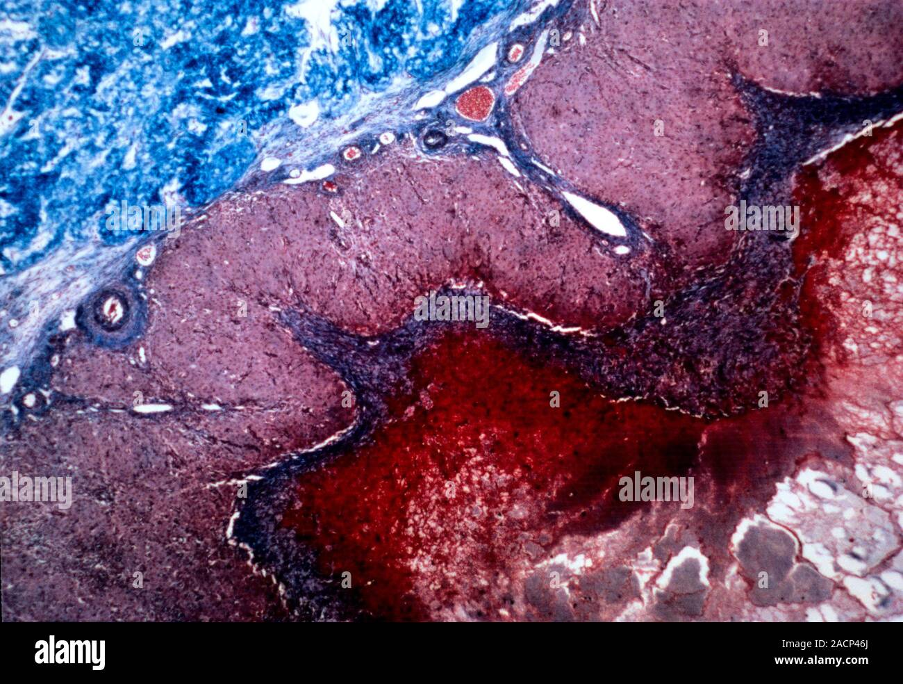 Corpus luteum. Light micrograph of a section through the corpus luteum ...