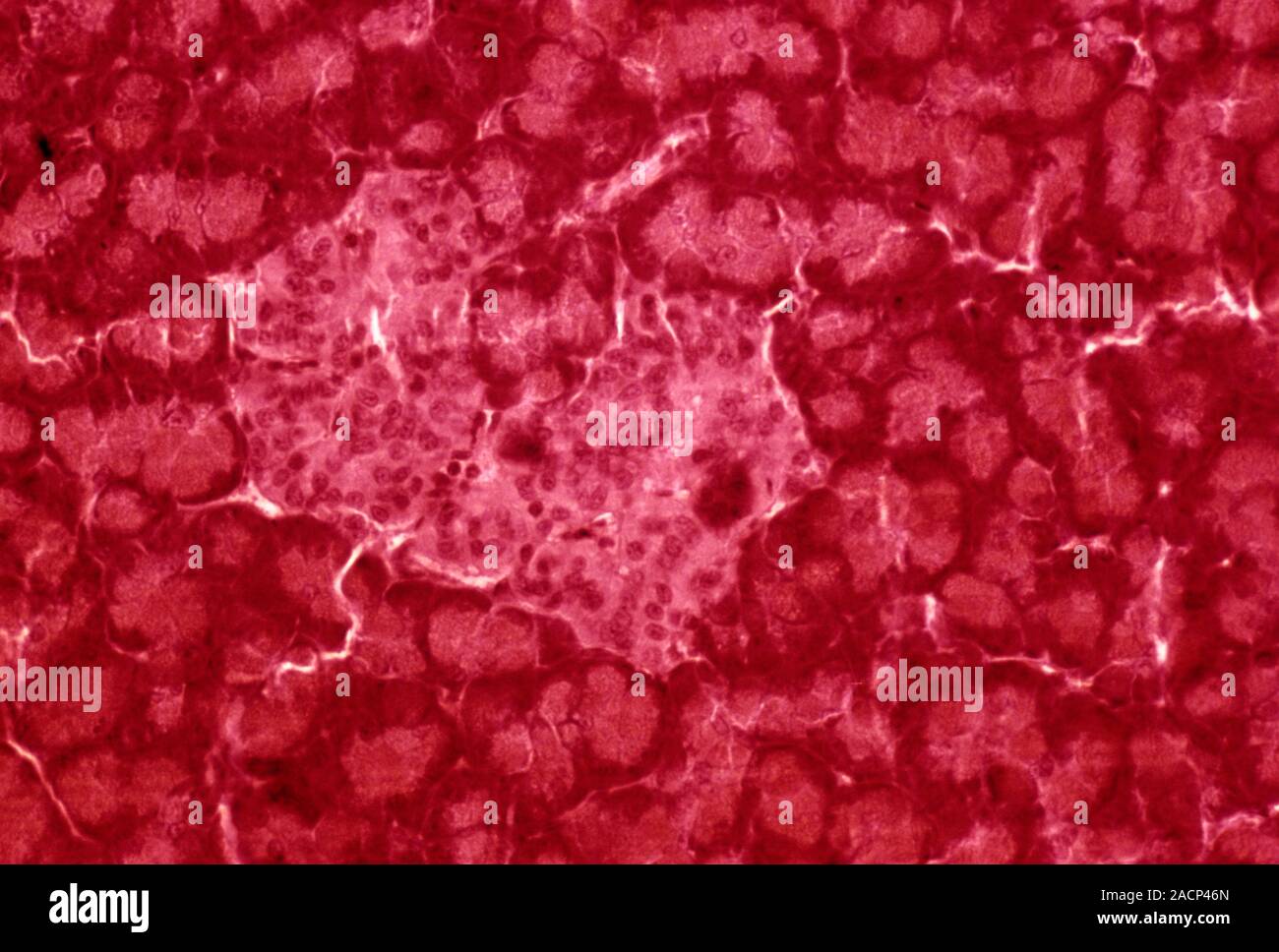 Islet of Langerhans. Light micrograph of a section through tissue from ...