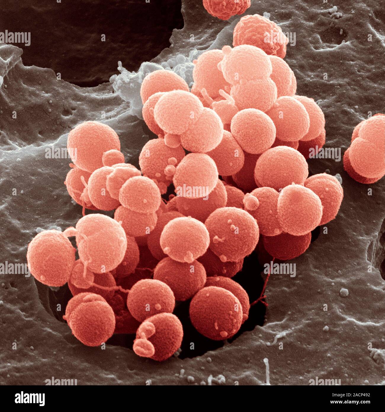 Neisseria Meningitidis Bacteria Neisseria Meningitidis: Biology,