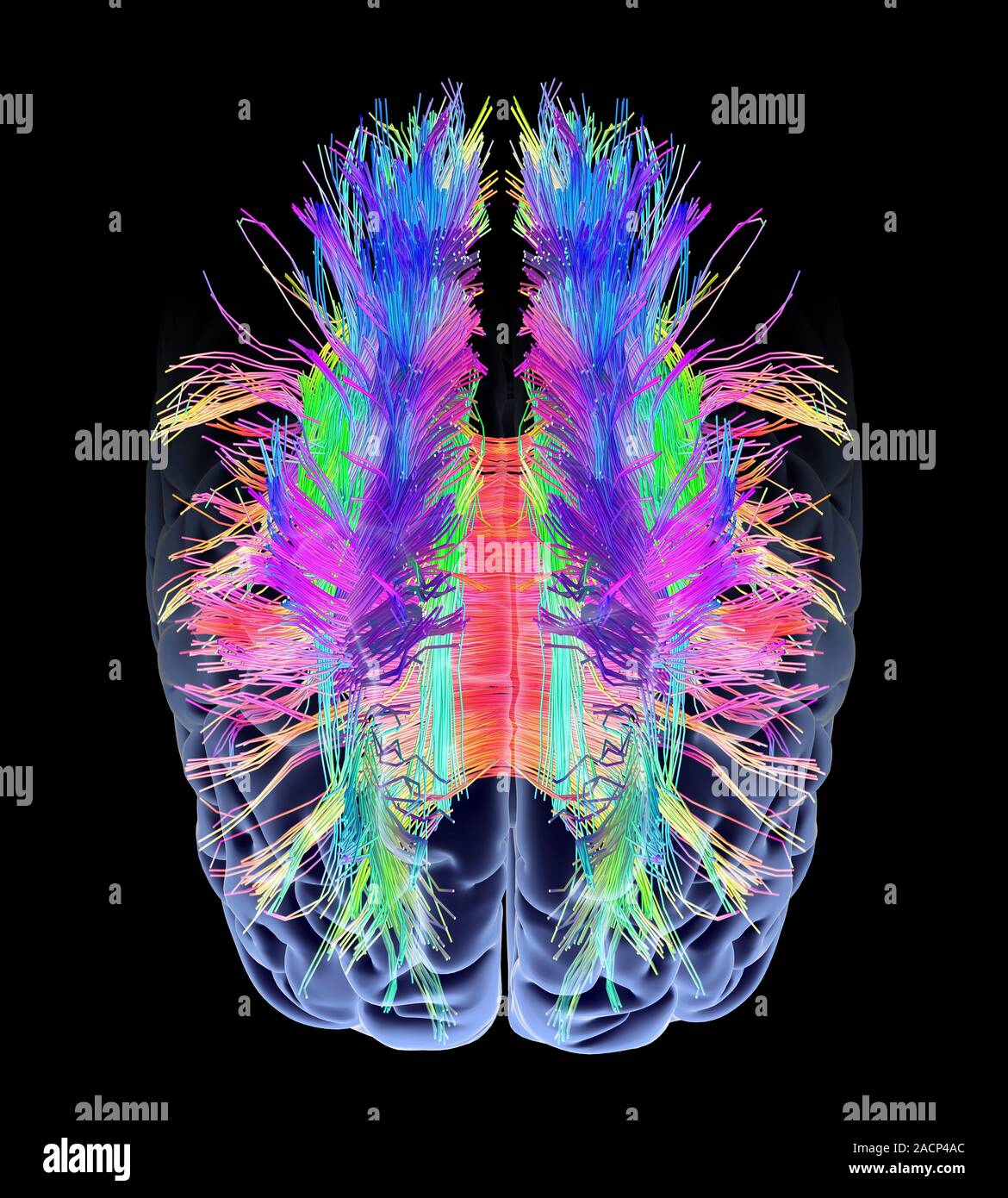 White matter fibres overlaid a 3d model of the human brain in top view ...