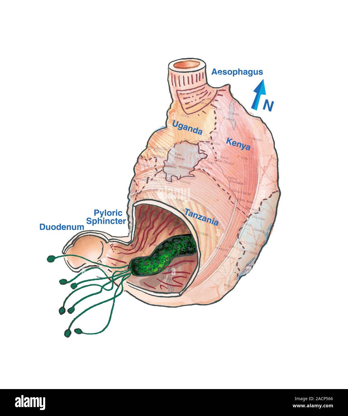 Stomach ulcer bacteria origins. Artwork of a human stomach and a ...
