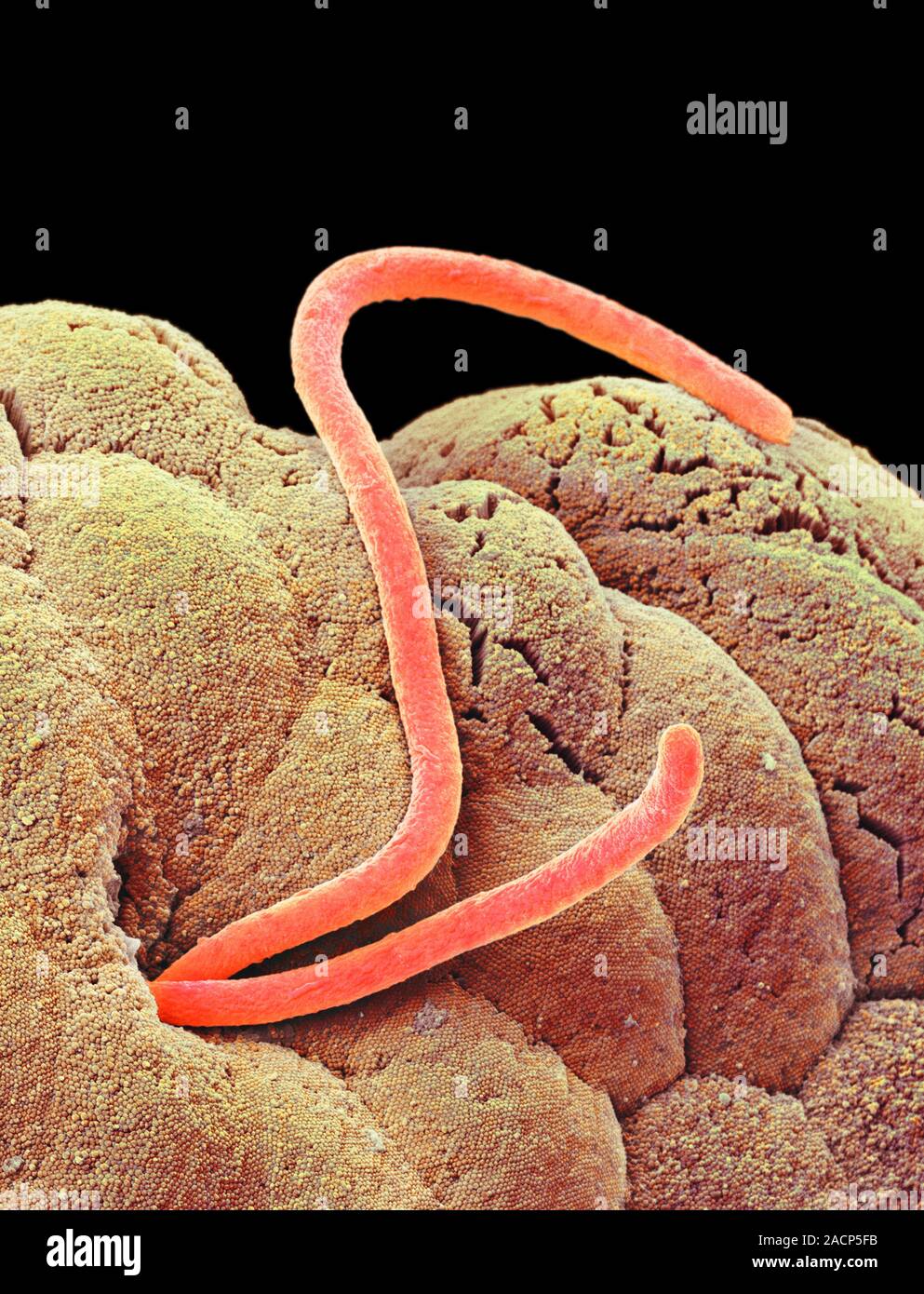 Threadworms In The Gut Coloured Scanning Electron Micrograph Sem Showing Threadworms