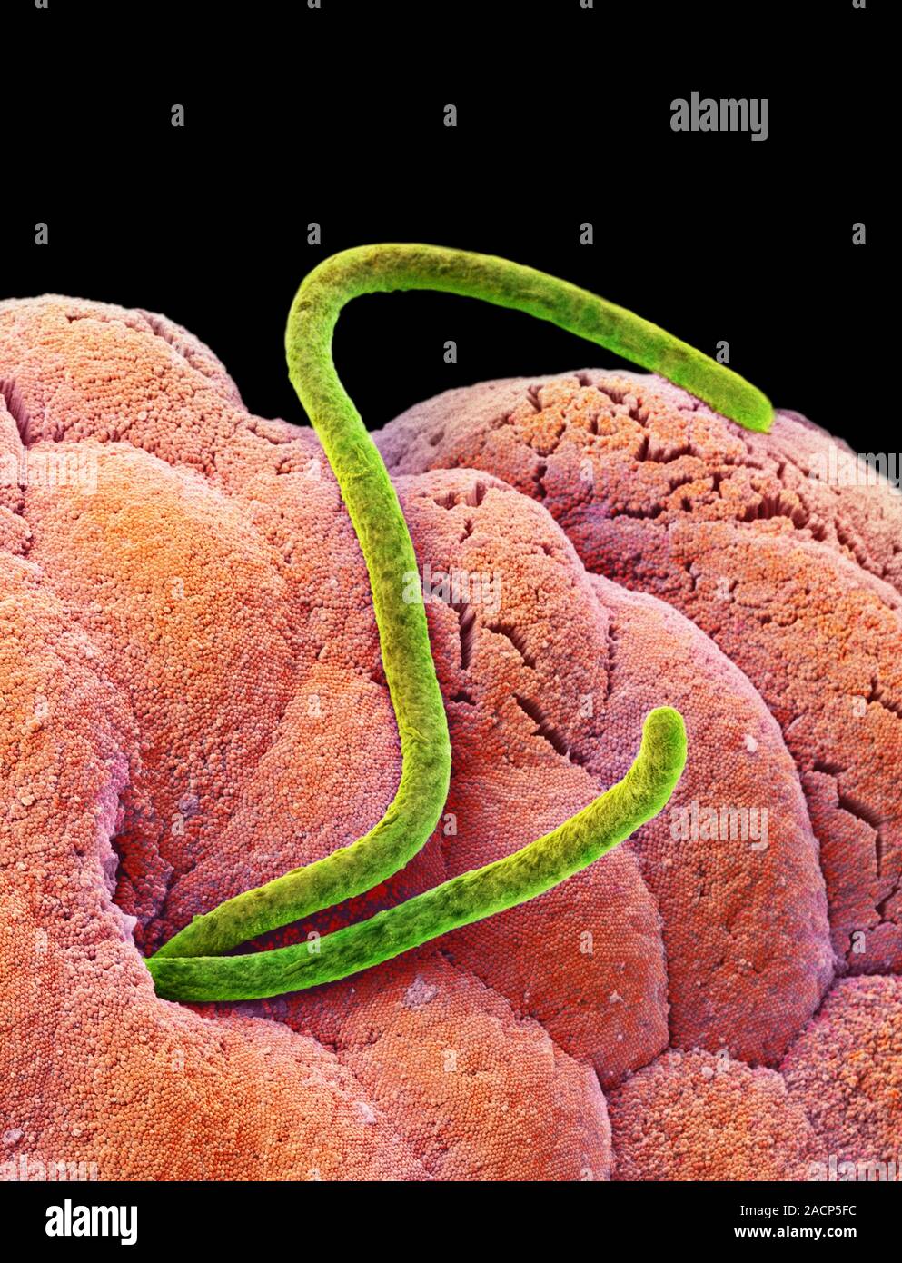 Threadworms In The Gut Coloured Scanning Electron Micrograph Sem Showing Threadworms