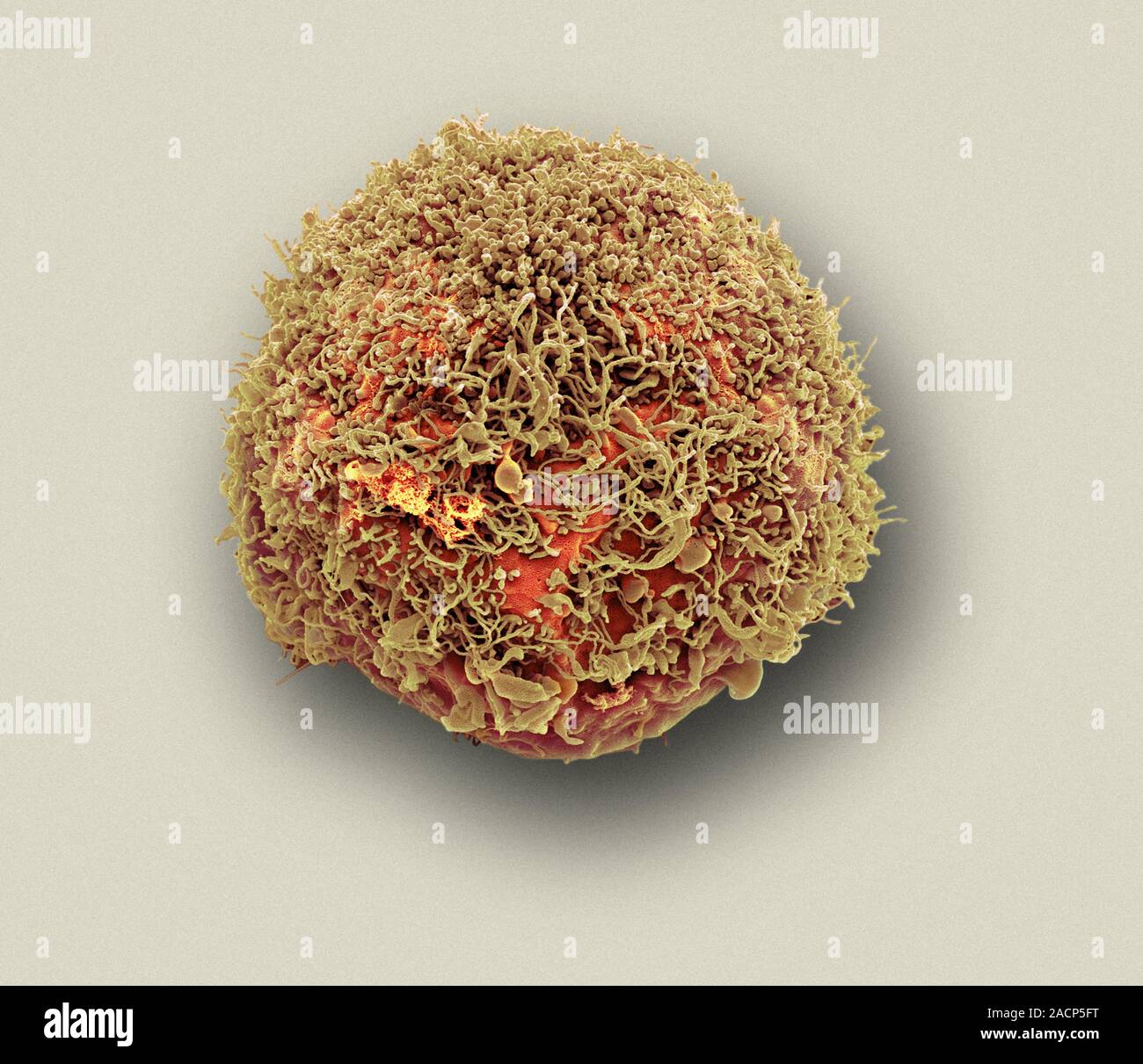 Mesenchymal stem cell. Coloured scanning electron micrograph (SEM) of a ...