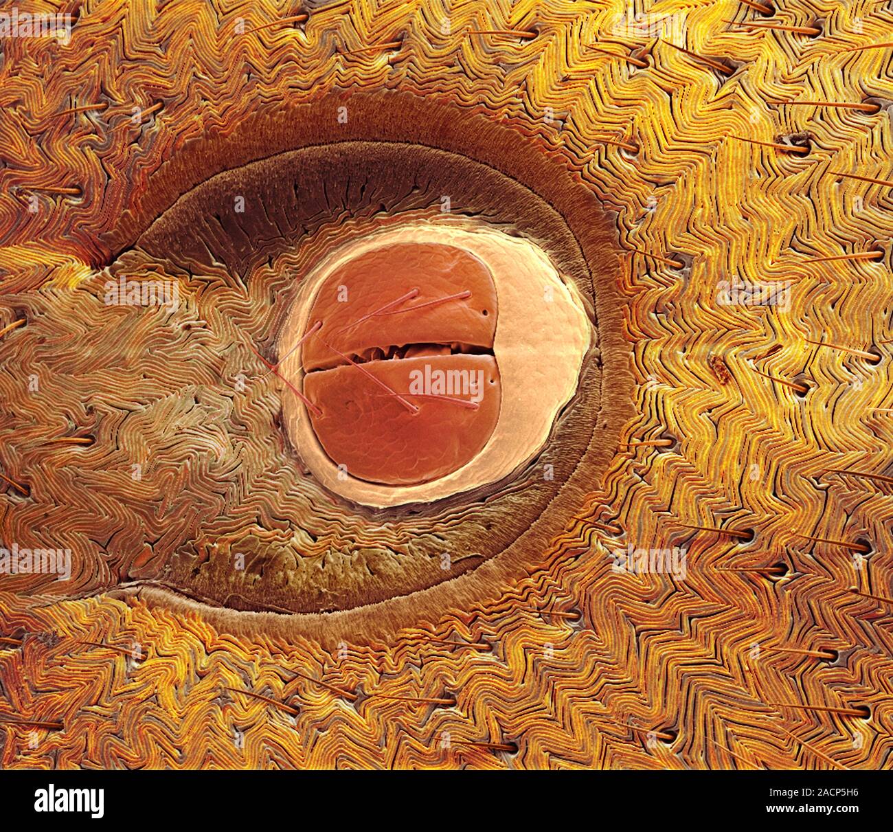 Tick anus. Coloured scanning electron micrograph (SEM) of a close-up of ...