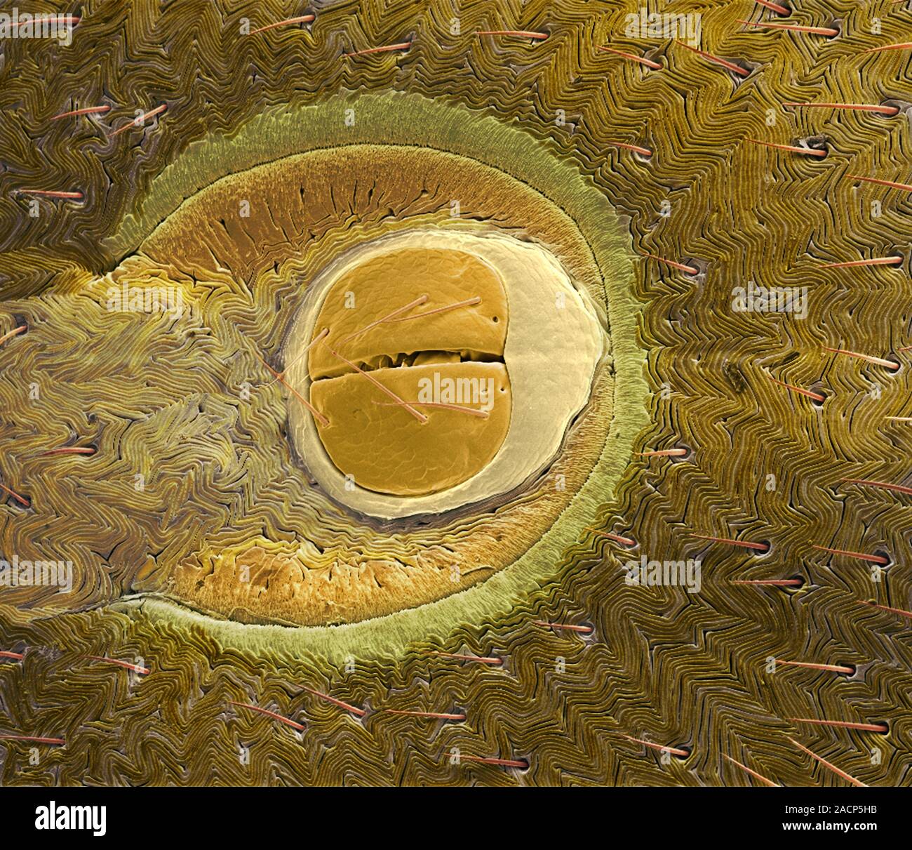 Tick anus. Coloured scanning electron micrograph (SEM) of a close-up of ...